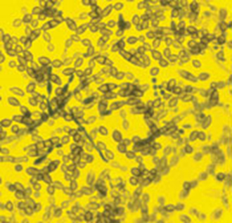 Mold Information Slideshow | US EPA