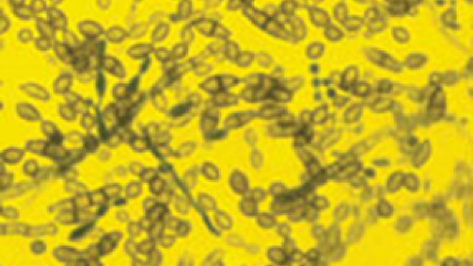 Mold Information Slideshow | US EPA