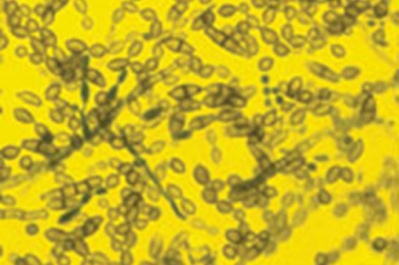 Mold Information Slideshow | Mold | US EPA